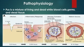 Skin-and-soft-tissue-infections-5.ppt... | PPT