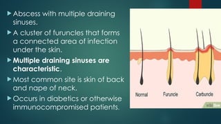 Skin-and-soft-tissue-infections-5.ppt... | PPT