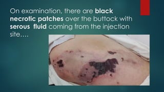 Skin-and-soft-tissue-infections-5.ppt... | PPT