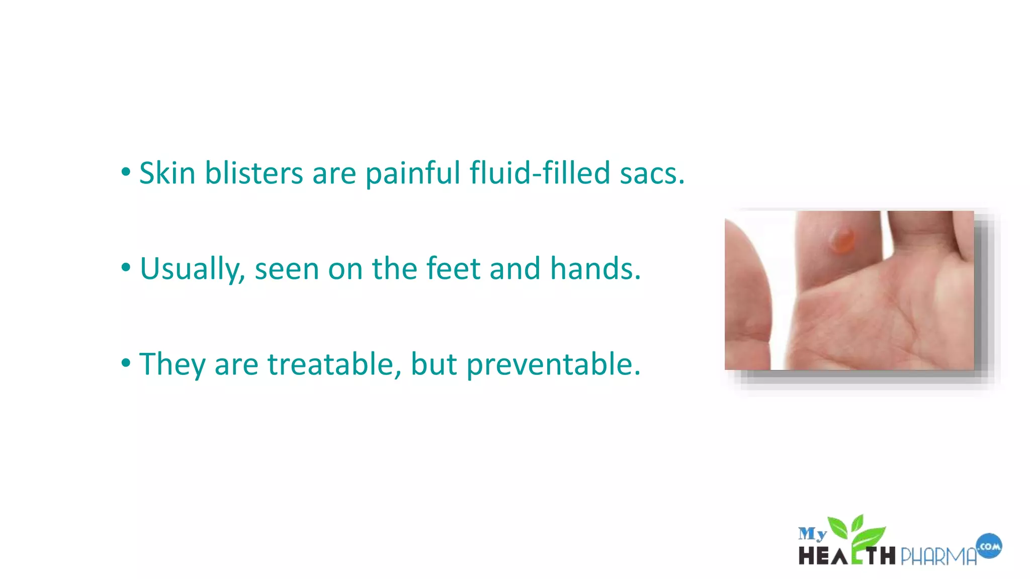 Skin Blisters Causes And treatment | PPTX
