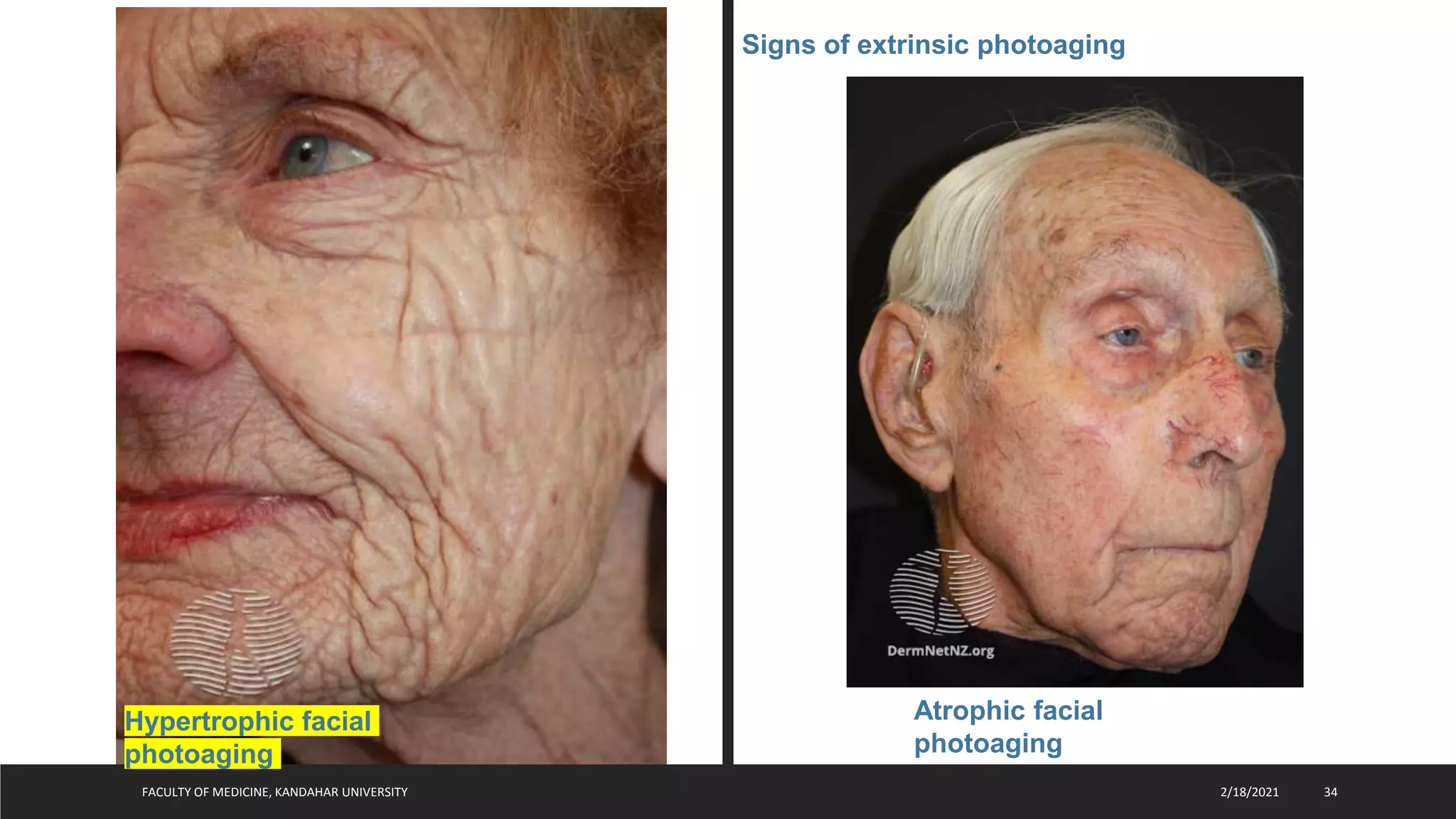 Skin ageing | PPTX