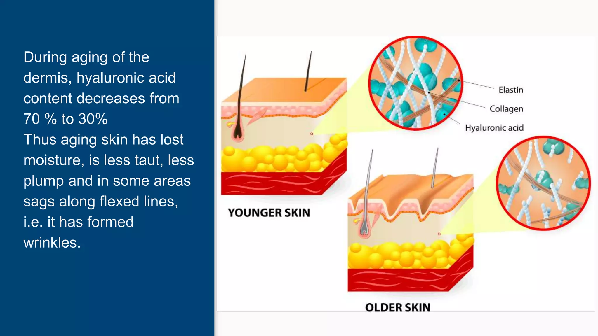 The Aging Process: Understanding the Elements of Elasticity Loss | PPTX
