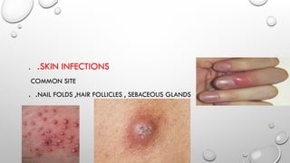 skin ami.pptx human applied /;'pokjnkkanatomy | PPTX