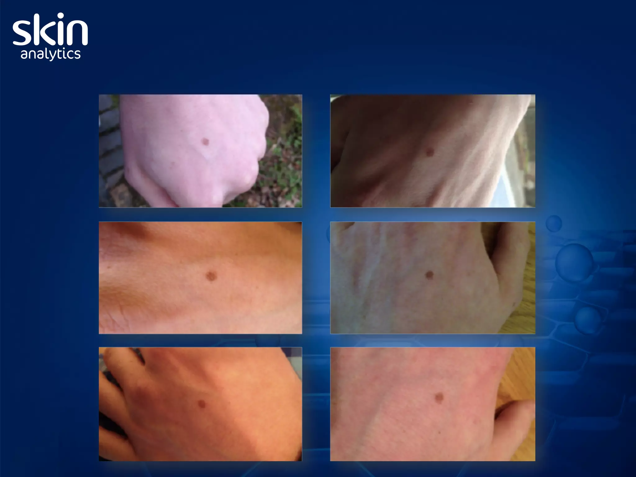 Skin Analytics Overview | PPT