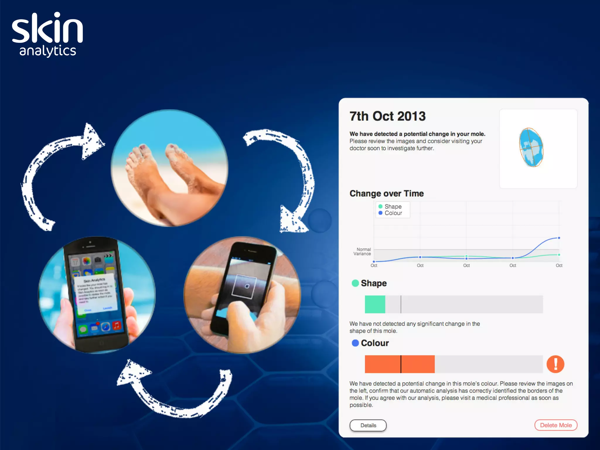 Skin Analytics Overview | PPT