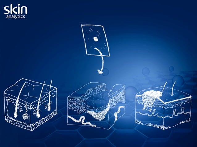 Skin Analytics Overview | PPT