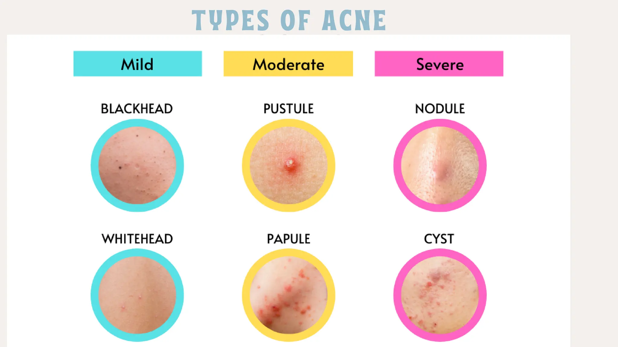 Skin Anatomy of human skin LAYERS OF SKIN | PDF