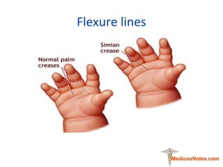 Skin and fascial medicos notes.com