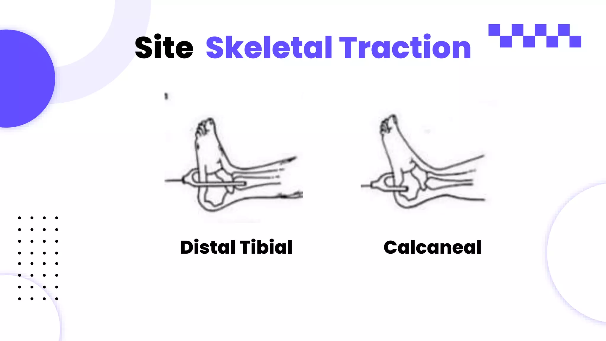 Skin and skeletal Traction.pptx