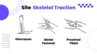 Skin and skeletal Traction.pptx