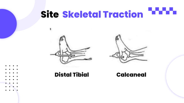 Skin and skeletal Traction.pptx