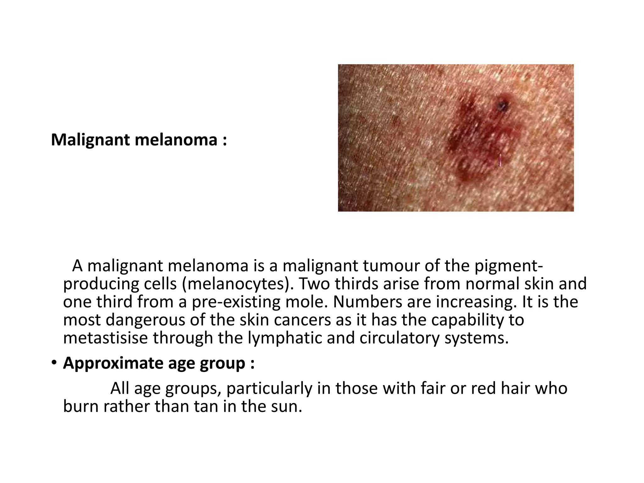 Skin and skin diseases | PPTX