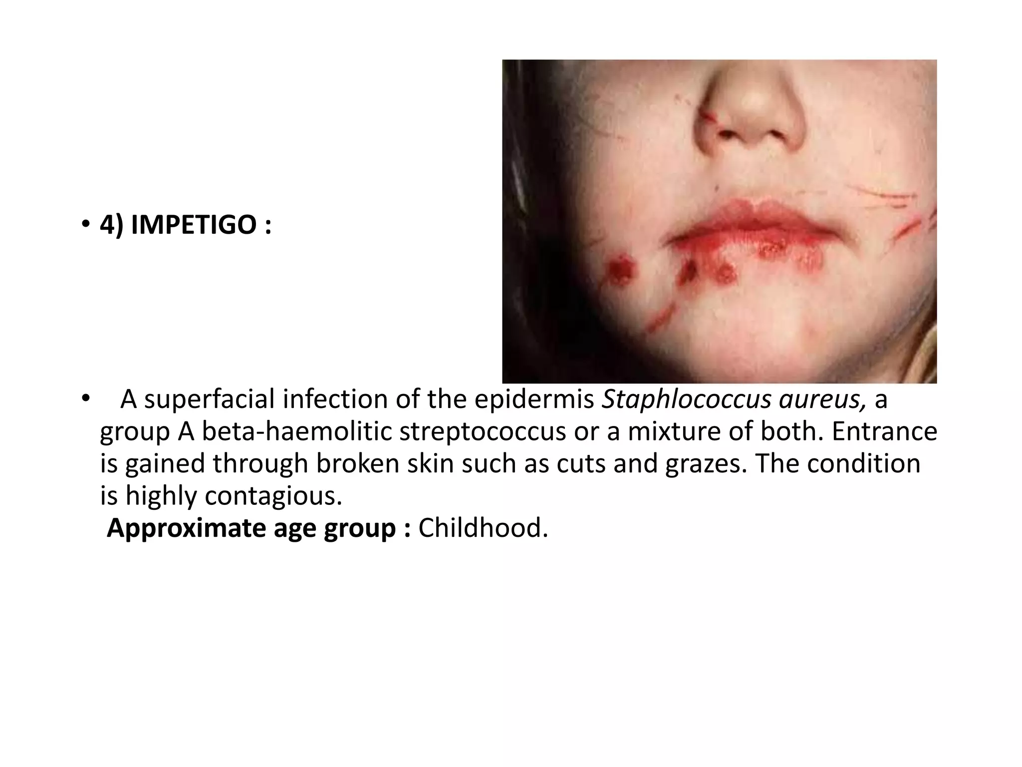 Skin and skin diseases | PPTX