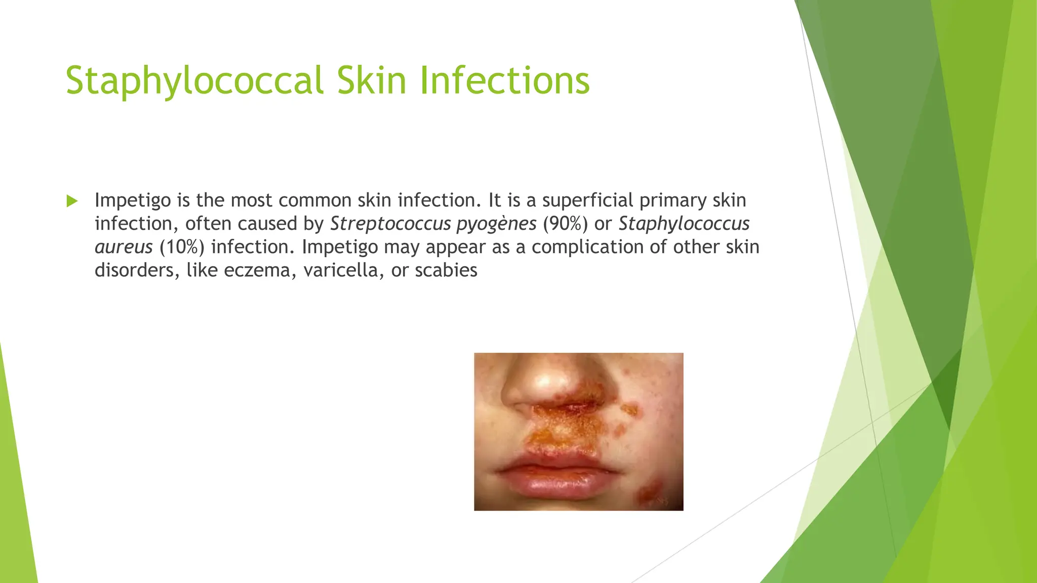 Explanation Skin and soft tissue infection | PPT