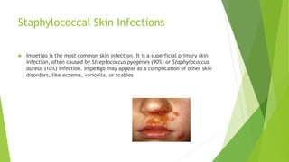 Explanation Skin and soft tissue infection | PDF