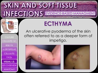 Skin and Soft Tissue Infections | PPTX