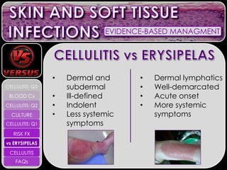 Erysipelas Vs Cellulitis