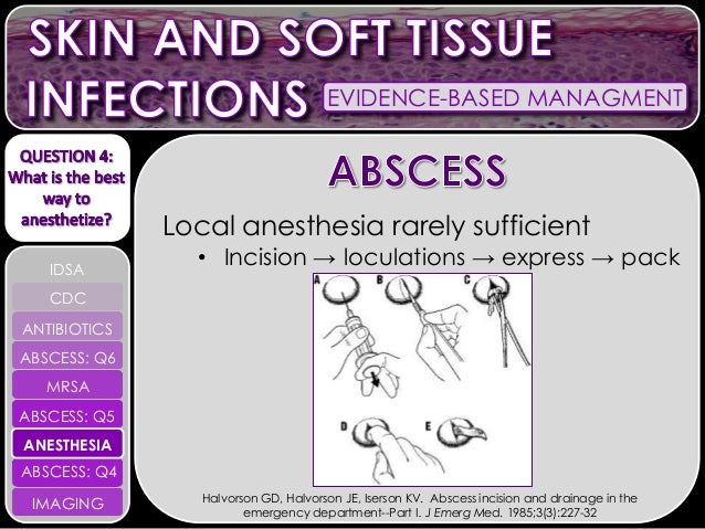 Skin and Soft Tissue Infections