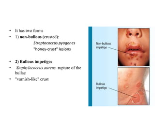 Skin and soft tissue infections | PPTX