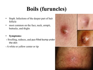 Skin and soft tissue infections | PPTX