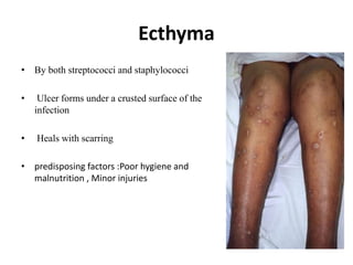 Skin and soft tissue infections | PPTX