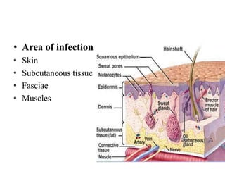 Skin and soft tissue infections | PPTX