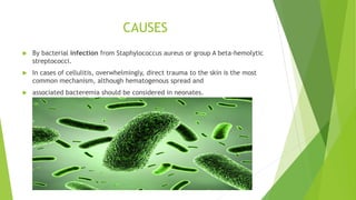 Skin and soft tissue infections | PDF