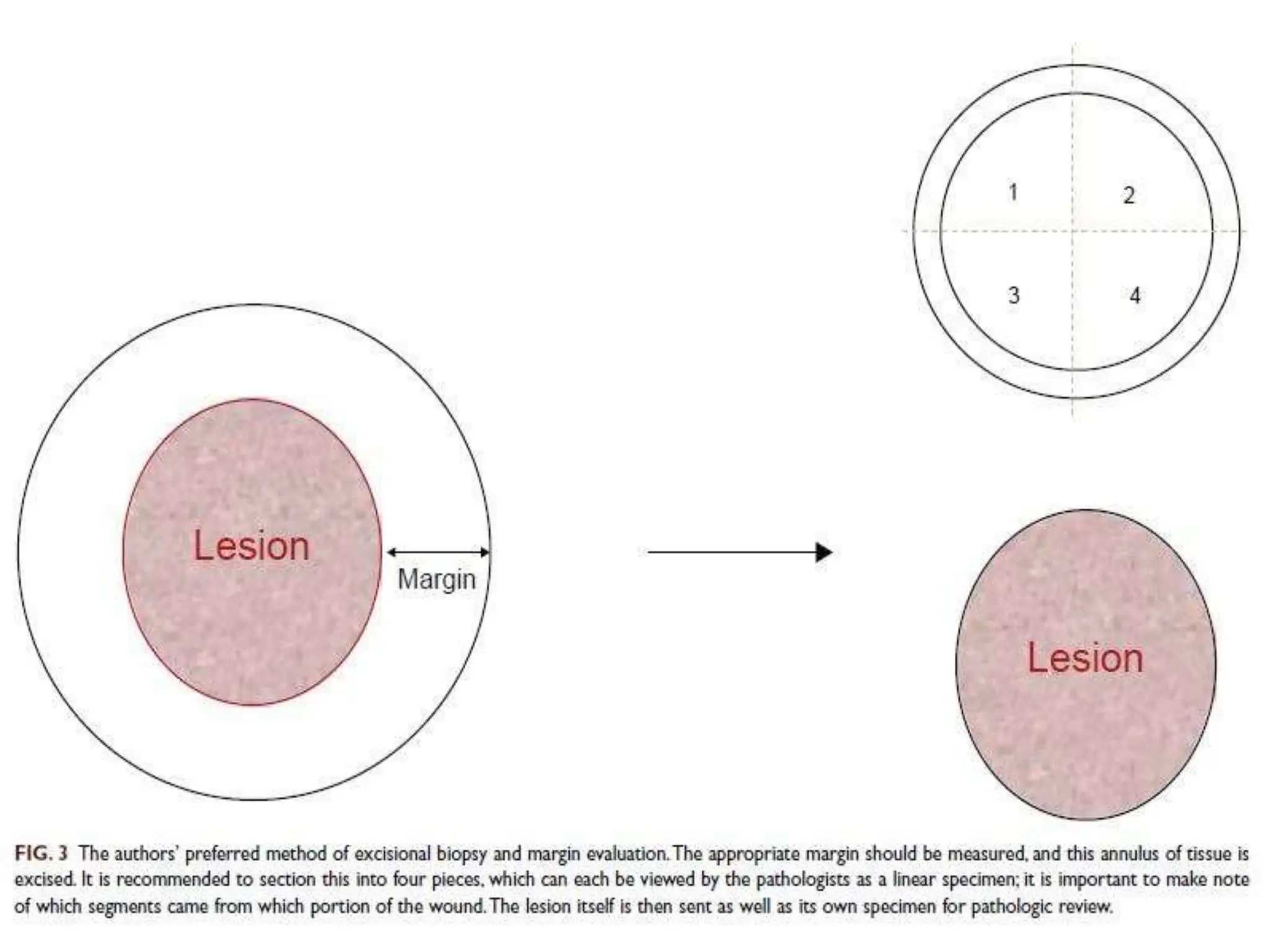 skin and subcutaneous swelling presentation | PPTX