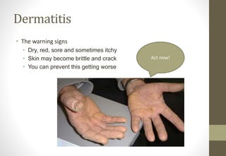 Skin at Work - Workers Guide | PPTX