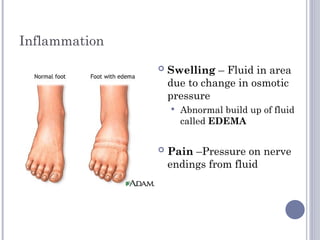 Skin, various diseases and problems on the skin and the Integumentary ...