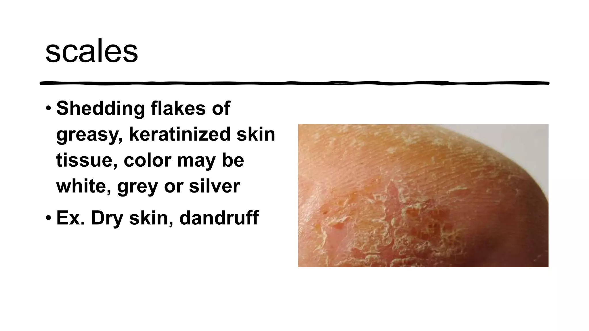 Skin assessment (1) | PPTX