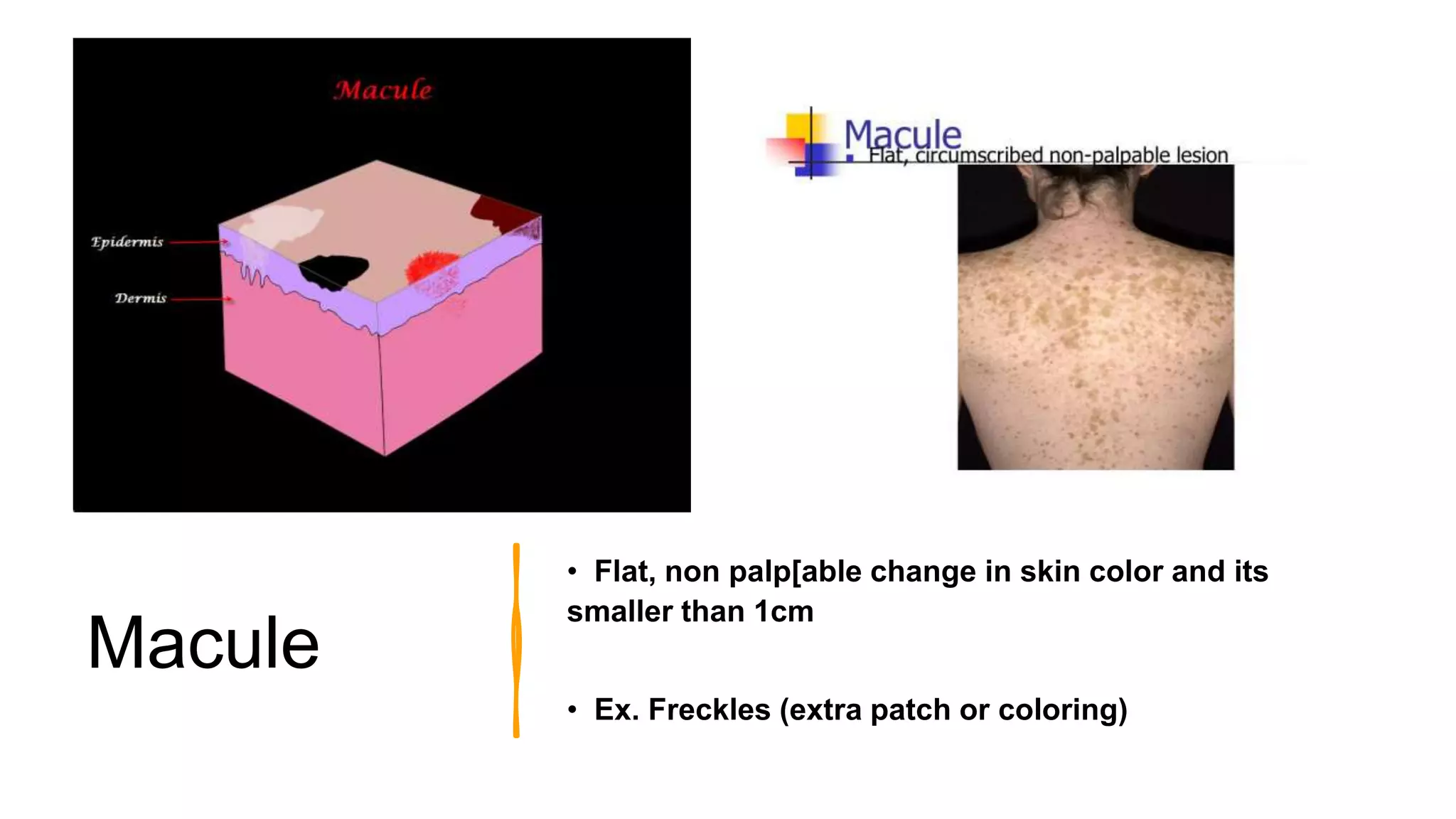 Skin assessment (1) | PPTX