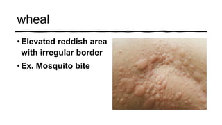 Skin assessment (1) | PPTX