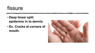 Skin assessment (1) | PPTX