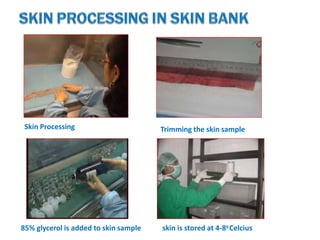 Skin banking | PPTX