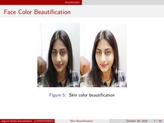 Skin beautification using golden ratio | PPT