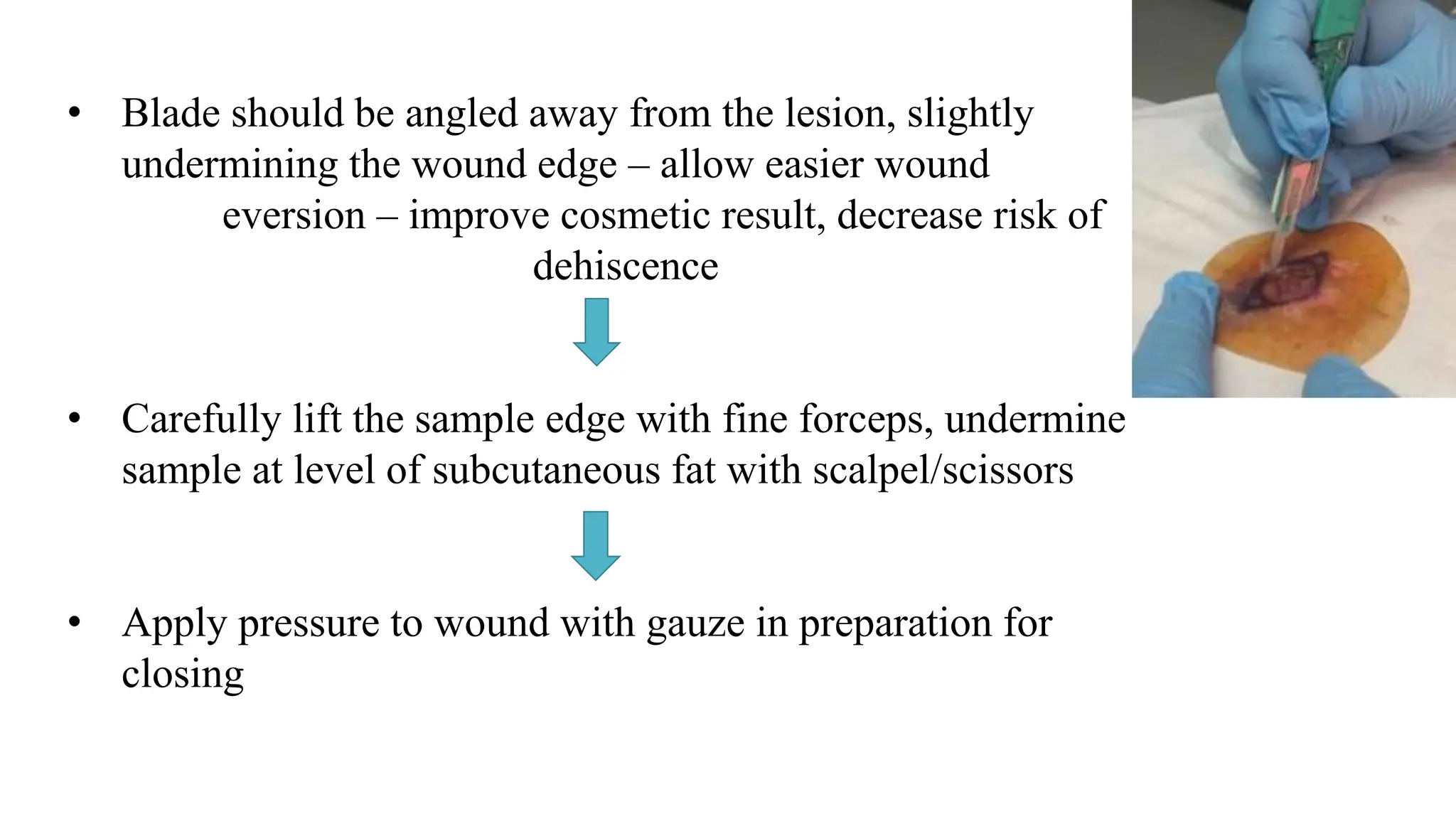 SKIN BIOPSY AND Slit skin smear examination.pptx