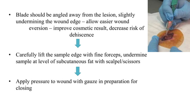 SKIN BIOPSY AND Slit skin smear examination.pptx