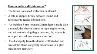 SKIN BIOPSY AND Slit skin smear examination.pptx