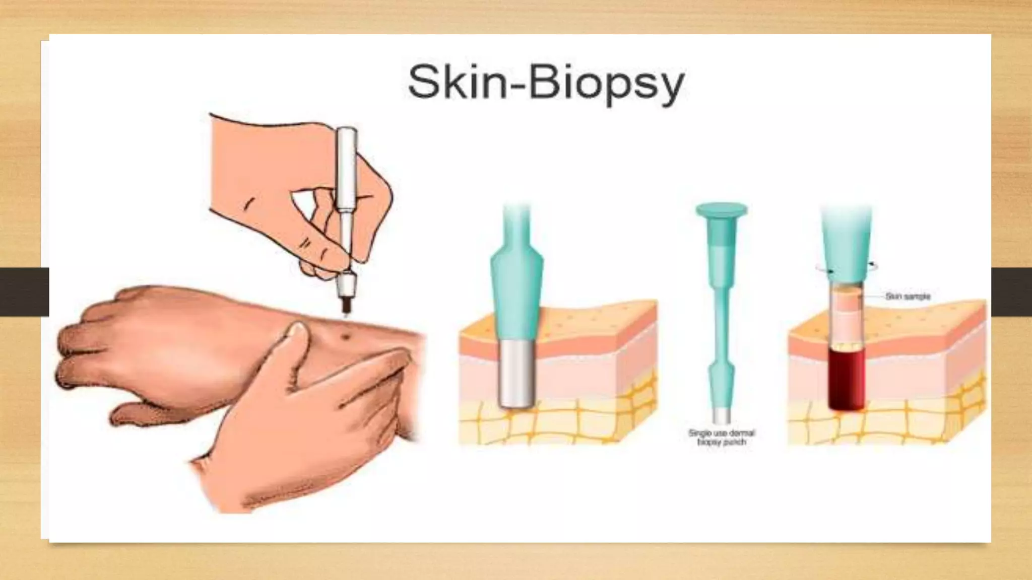SKIN BIOPSY PPT.pptx