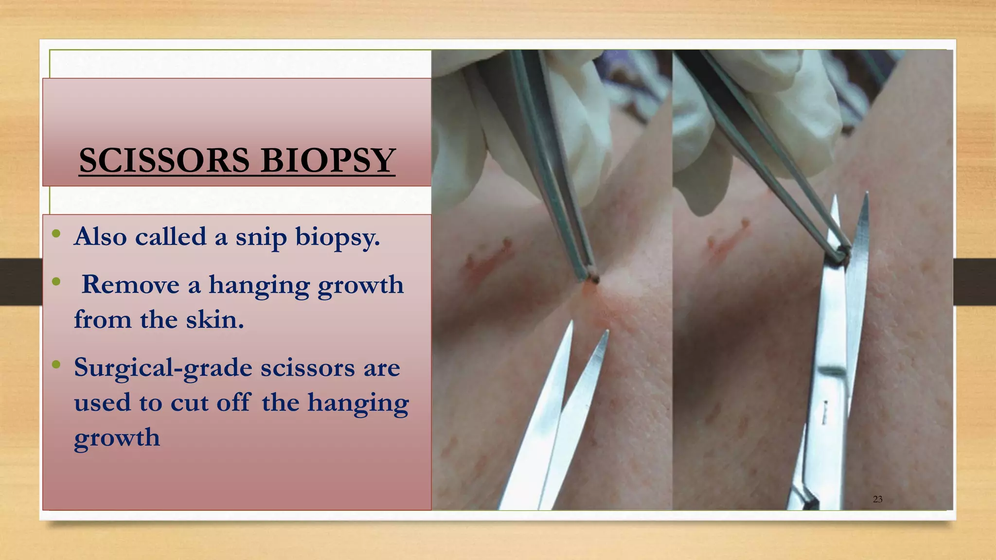 SKIN BIOPSY PPT.pptx