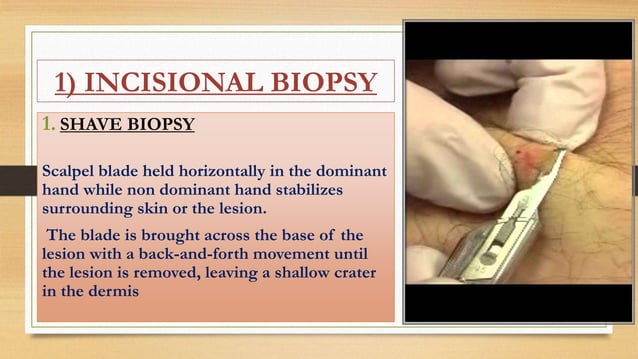 SKIN BIOPSY PPT.pptx
