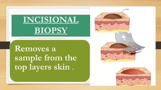 SKIN BIOPSY PPT.pptx
