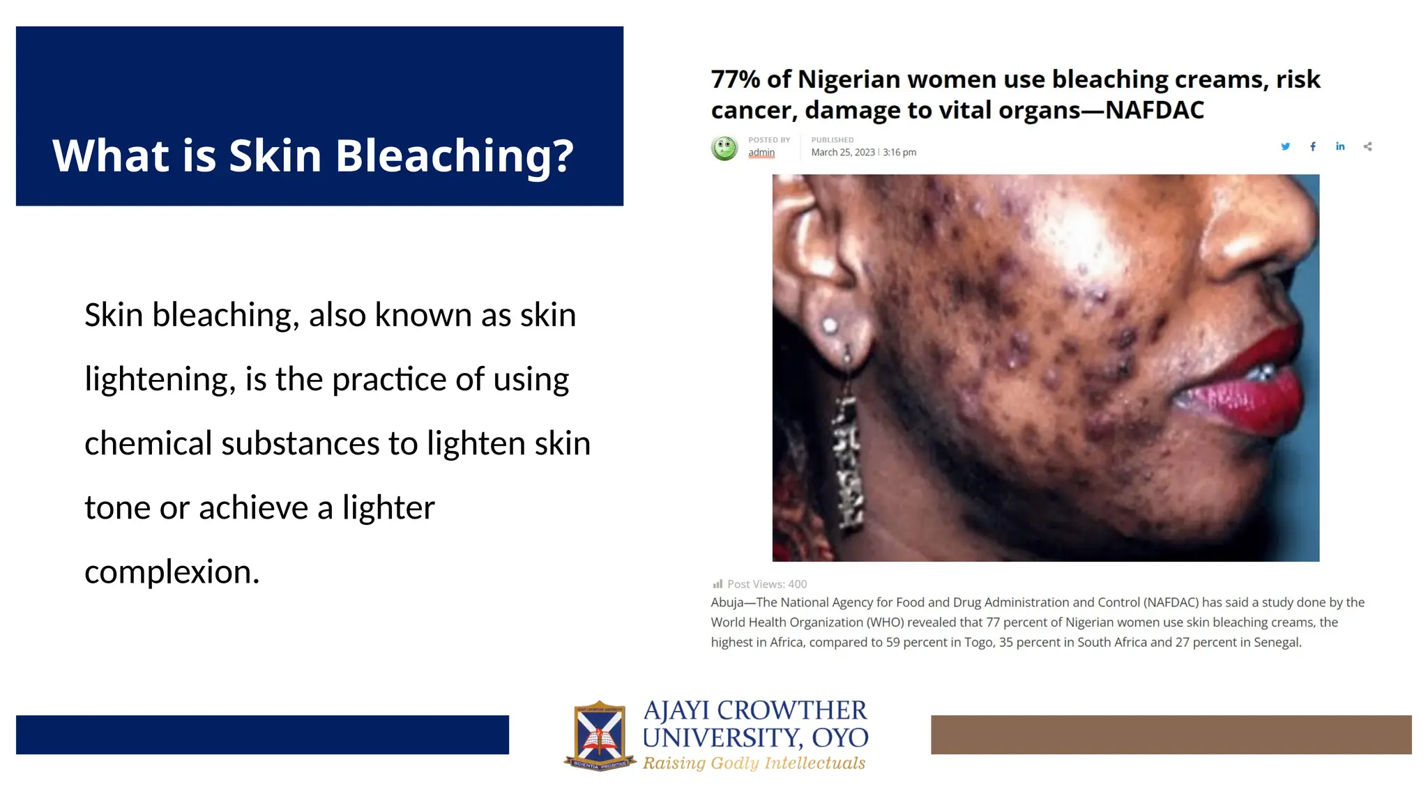 SKIN BLEACHING: ENVIRONMENTAL AND PUBLIC HEALTH IMPLICATIONS.pptx
