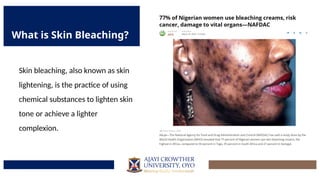 SKIN BLEACHING: ENVIRONMENTAL AND PUBLIC HEALTH IMPLICATIONS.pptx