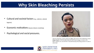 SKIN BLEACHING: ENVIRONMENTAL AND PUBLIC HEALTH IMPLICATIONS.pptx