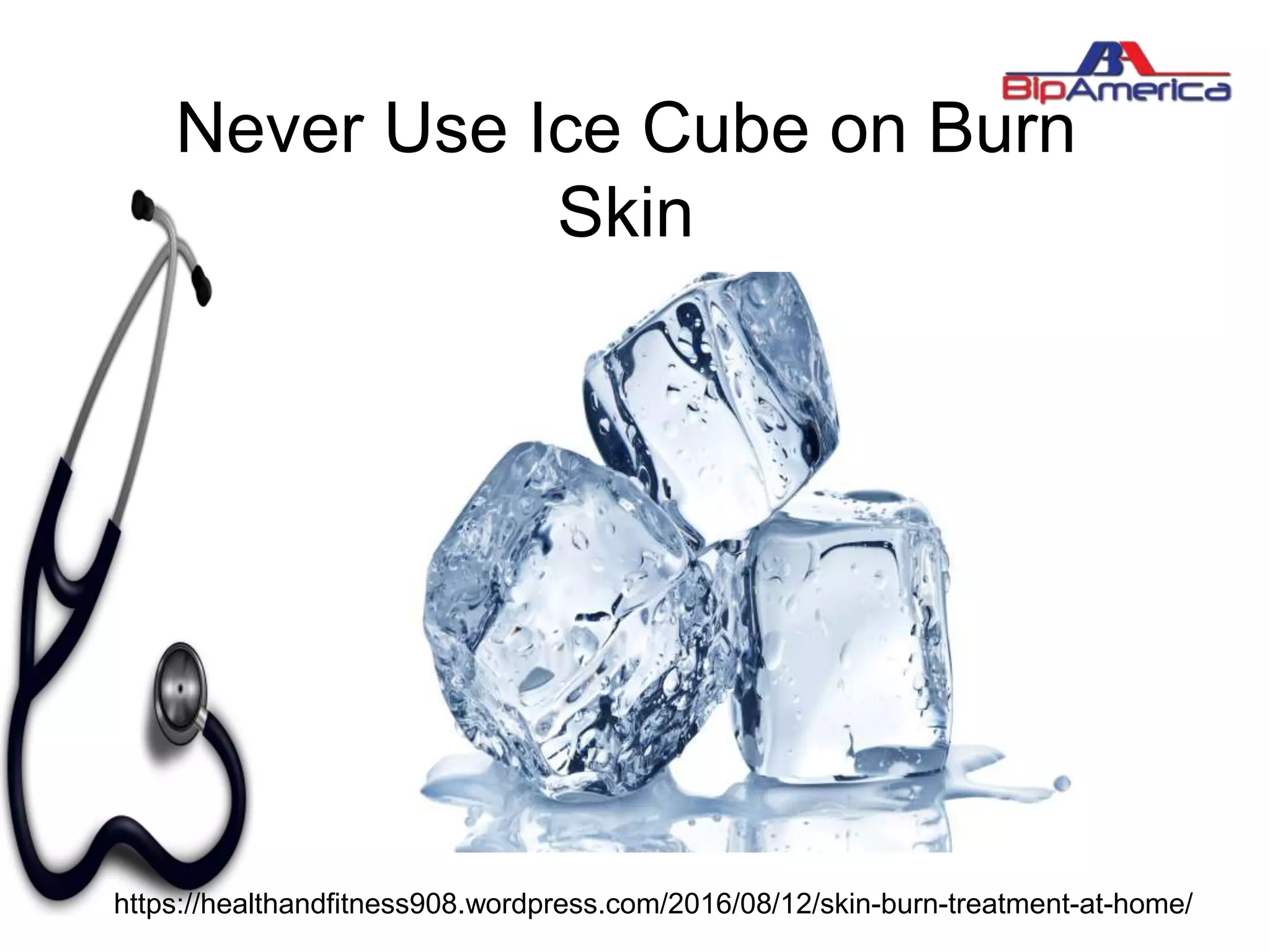 Skin burn treatment at home | PPTX