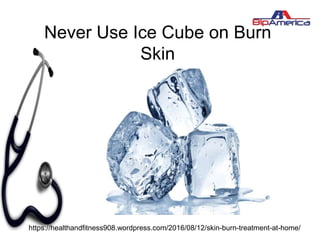 Skin burn treatment at home | PPTX