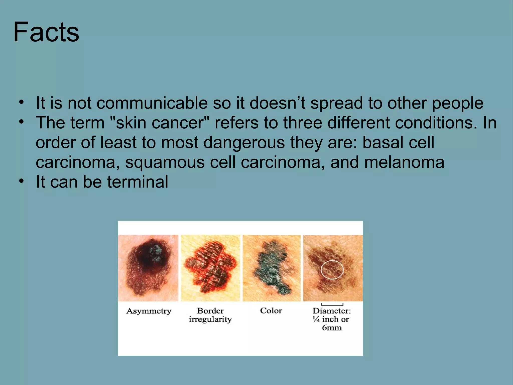Skin cancer | PPT