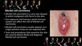 Skin cancer | PPTX